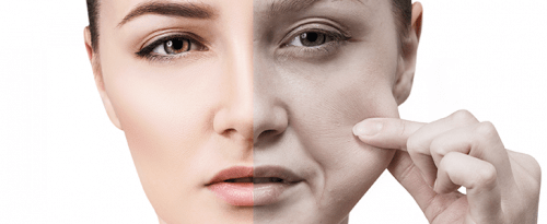 Flacidez facial | Dra Renata Mitelman Dermatologia